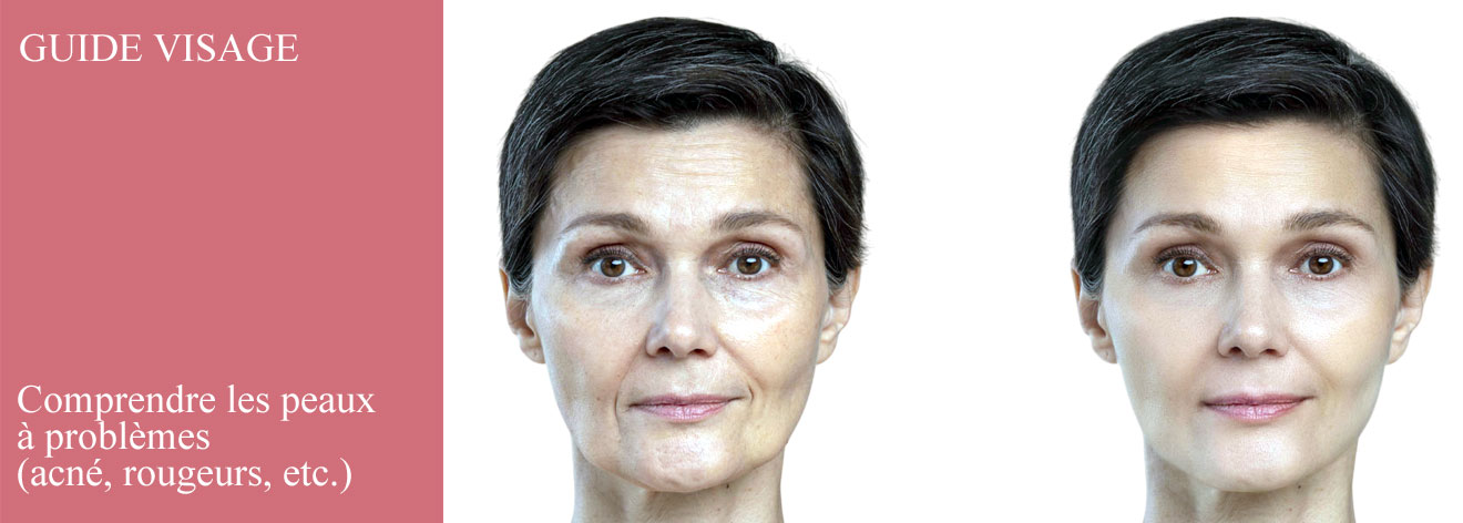 Soins du visage pour peaux à problèmes : acné, rougeurs, imperfections ...